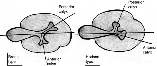 Anatomy for PNL | SpringerLink