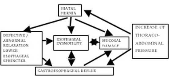 Gastroesophageal Reflux Disease: Pathophysiology | SpringerLink