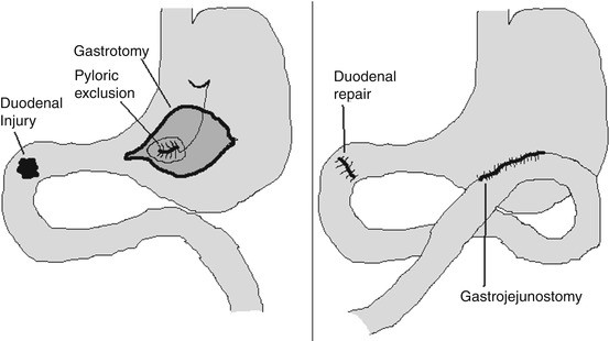 Abdominal Trauma | SpringerLink