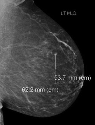 Magnification and Compression Views | SpringerLink