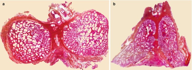 Structure of the Bulbo-clitoral Organ | SpringerLink