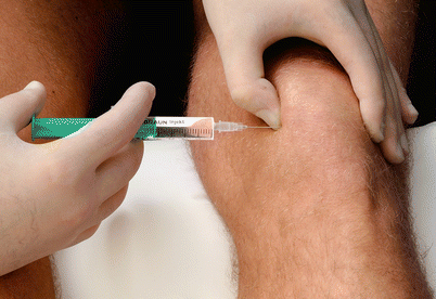 Knee Joint: Intra-articular Injection | SpringerLink