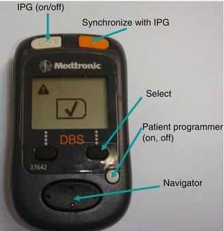 Instrument of Brain Stimulation | SpringerLink