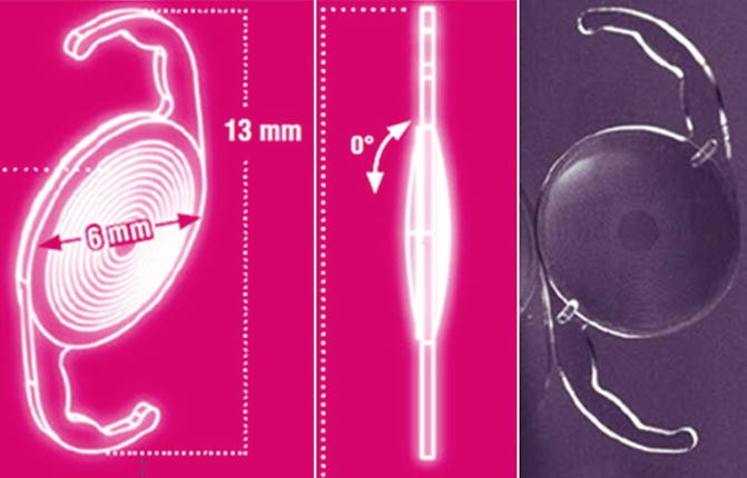 Multifocal Intraocular Lenses: Types and Models | SpringerLink