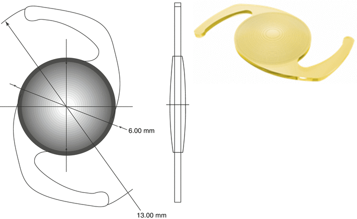 Multifocal Intraocular Lenses: Types and Models | SpringerLink