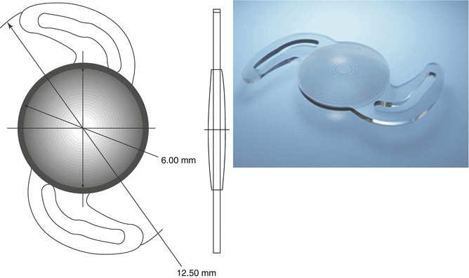 Multifocal Intraocular Lenses: Types and Models | SpringerLink