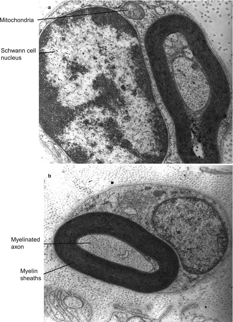Ultrastructure of Myelinated and Unmyelinated Axons | SpringerLink