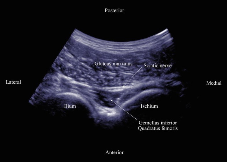 High-Definition and Three-Dimensional Volumetric Ultrasound Imaging of ...