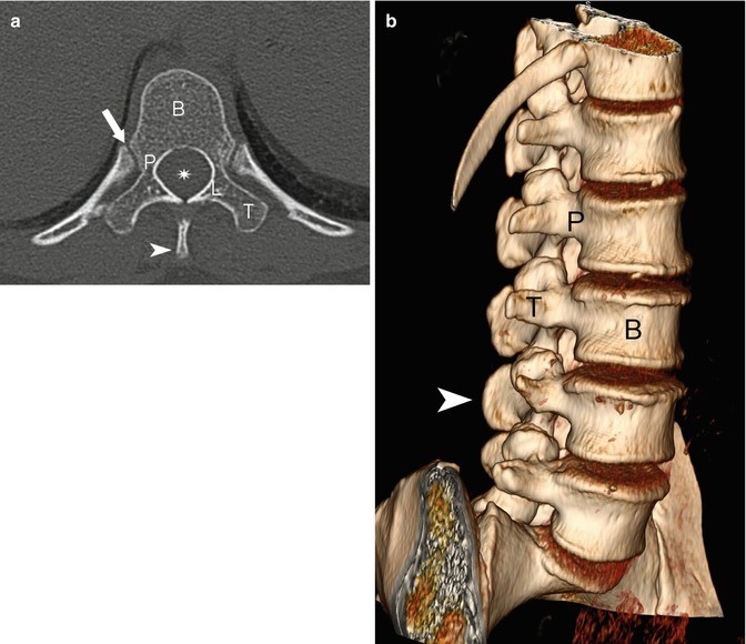 Spine | SpringerLink
