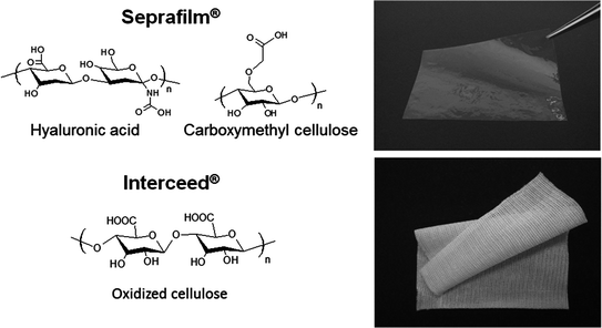 Polymers for Surgery | SpringerLink