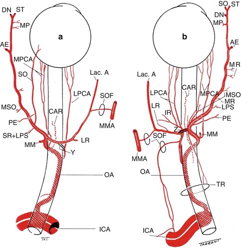 The Ophthalmic Artery | SpringerLink