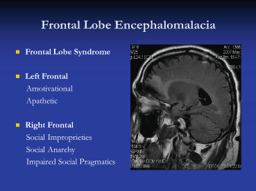 Frontal Lobe Syndromes | SpringerLink