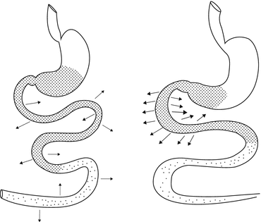 Sleeve Gastrectomy and Transit Bipartition | SpringerLink