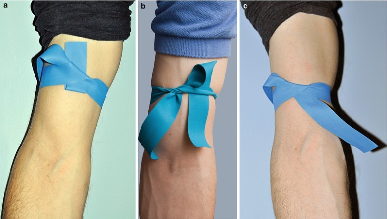 Venipuncture | SpringerLink