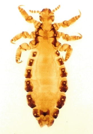 Sucking and Chewing Lice | SpringerLink