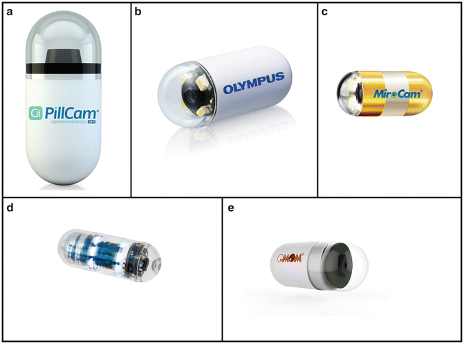 Small Bowel Capsule Endoscopy | SpringerLink