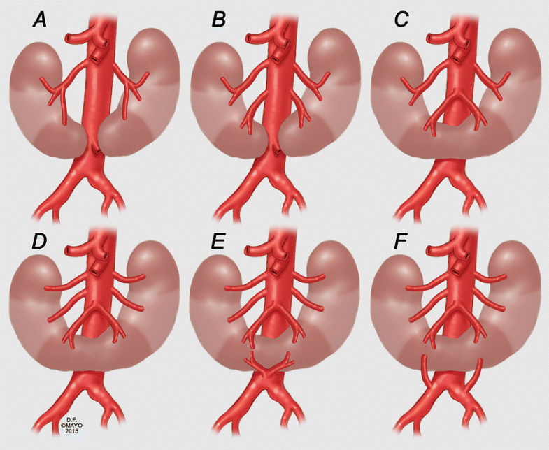 Normal Aortic Anatomy and Variations of Its Branches | SpringerLink