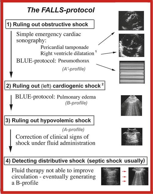 Lung Ultrasound for the Diagnosis and Management of an Acute ...