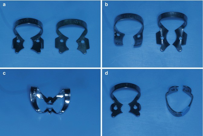 Rubber Dam | SpringerLink