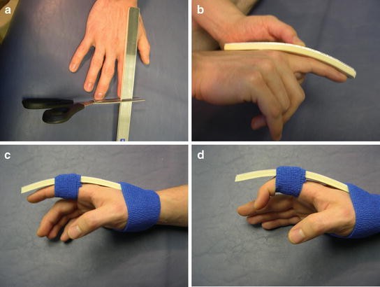 Soft Tissue Injuries | SpringerLink
