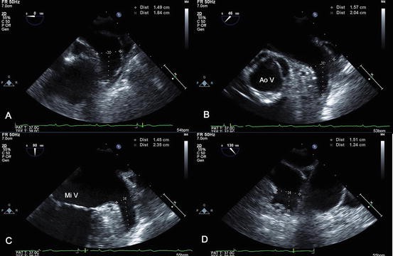 WATCHMAN Device | SpringerLink