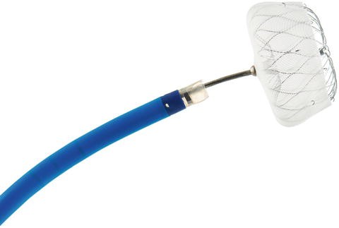 WATCHMAN Device | SpringerLink