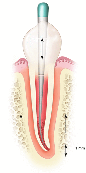 Manual Dynamic Activation (MDA) Technique | SpringerLink
