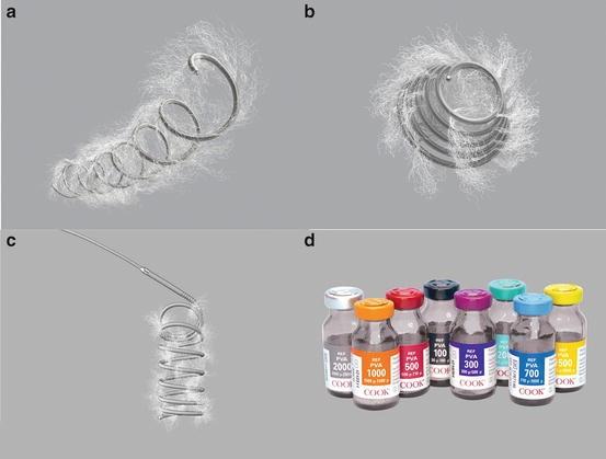 Embolization Materials and Principles | SpringerLink