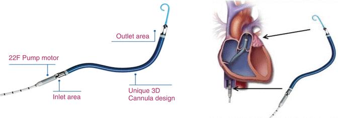Mechanical Support of the Right Heart | SpringerLink