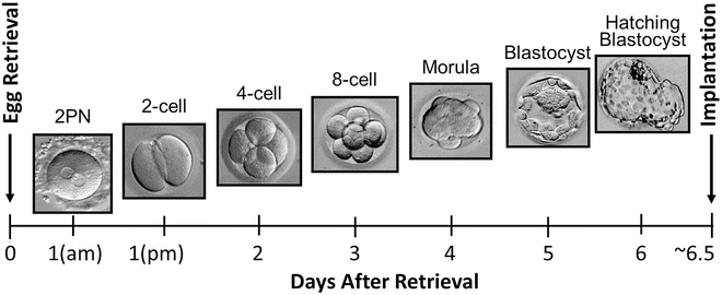 Current Status of Time-Lapse Microscopy for Embryo Selection | SpringerLink