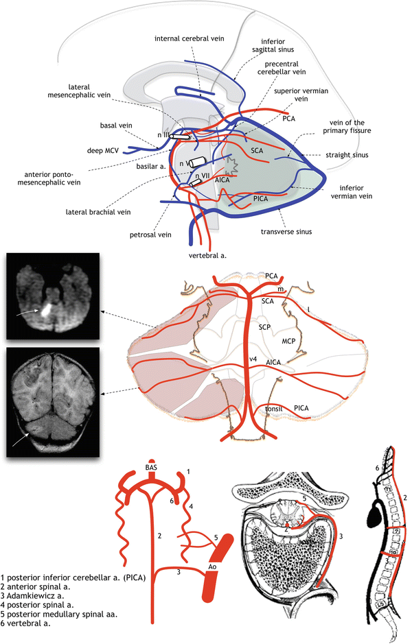 Neonatal Stroke: Clinical Presentation, Imaging, Treatment, and ...
