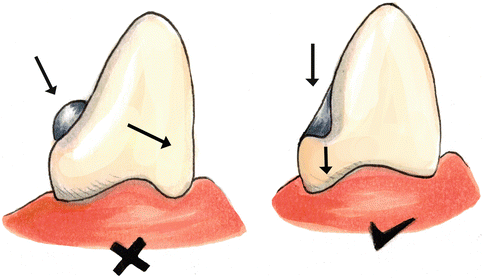 Rests and Rest Seats | SpringerLink