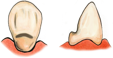 Rests and Rest Seats | SpringerLink