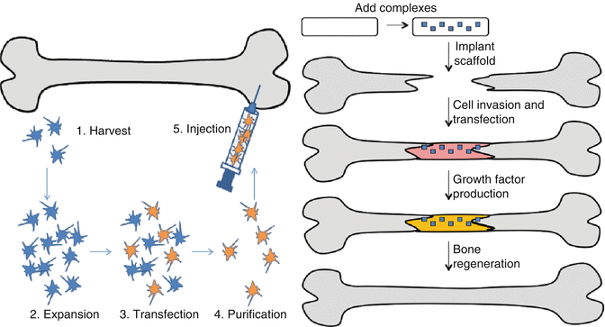 Gene-Based Approaches to Bone Regeneration | SpringerLink