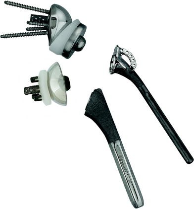 Exactech Equinoxe RTSA Platform Shoulder System Design Rationale ...