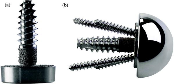 Tornier Aequalis Ascend™ Flex Convertible Shoulder System | SpringerLink