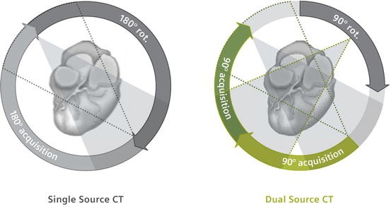 Technical Advancements in Dual Energy | SpringerLink