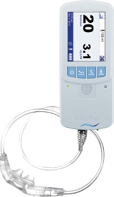 Noninvasive Open Ventilation (NIOV™) Therapy: Clinical Implications ...