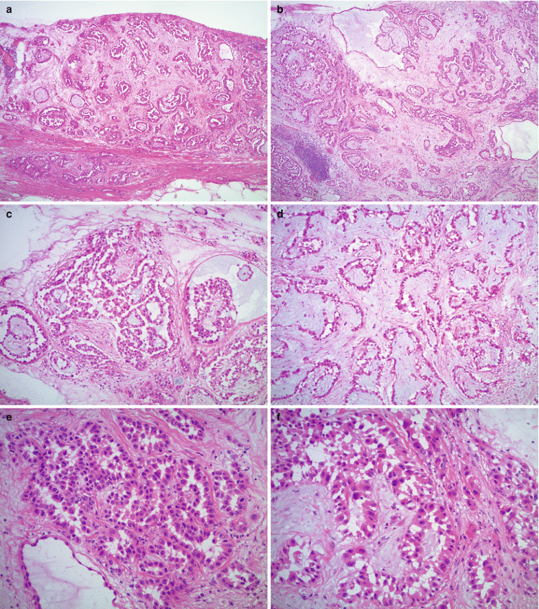 Peritoneum | SpringerLink