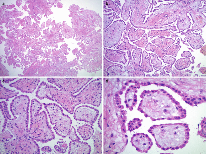 Peritoneum | SpringerLink
