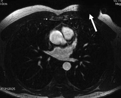 MRI Safety | SpringerLink