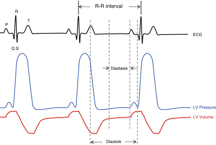 Principles of ECG Gating for CMR | SpringerLink