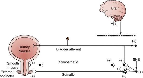 Neuromodulation Treatment of Underactive Bladder | SpringerLink