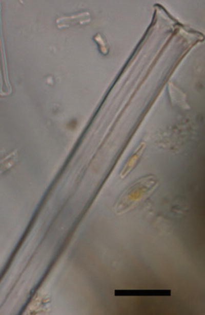Exocellular Polysaccharides in Microalgae and Cyanobacteria: Chemical ...