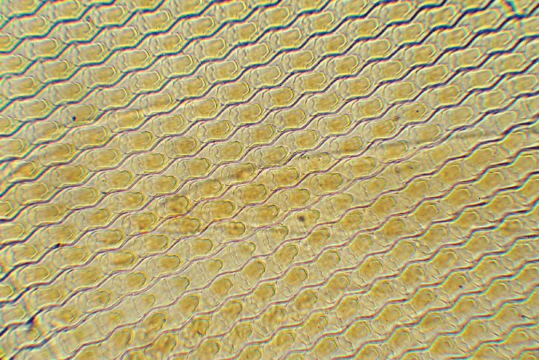 Dissection of a Snail ( Helix pomatia) | SpringerLink