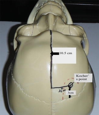 Extraventricular Drains and Ventriculostomy | SpringerLink