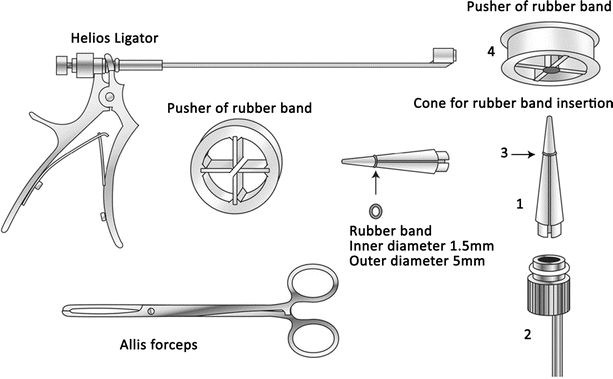 Hemorrhoids | SpringerLink