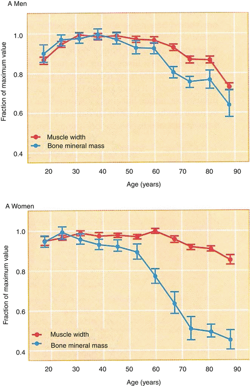 The Muscle-Bone Connection | SpringerLink