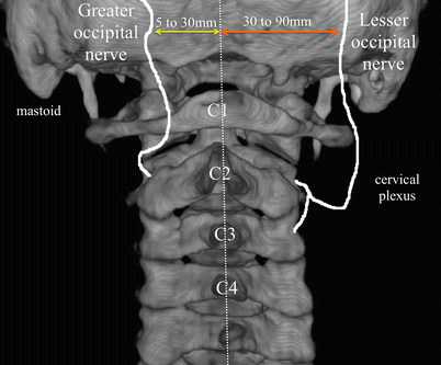Lesser Occipital Nerve Entrapment | SpringerLink