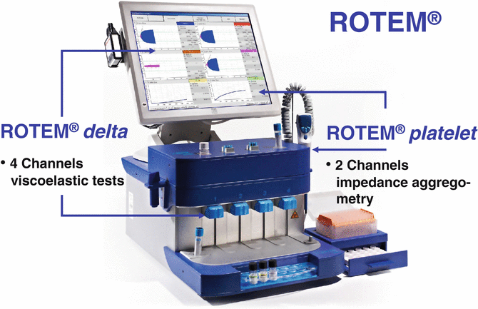 Rotational Thromboelastometry (ROTEM®) | SpringerLink